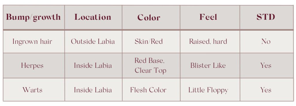 Questions About the Female Anatomy That You Feel Shy to Ask About – RED ...