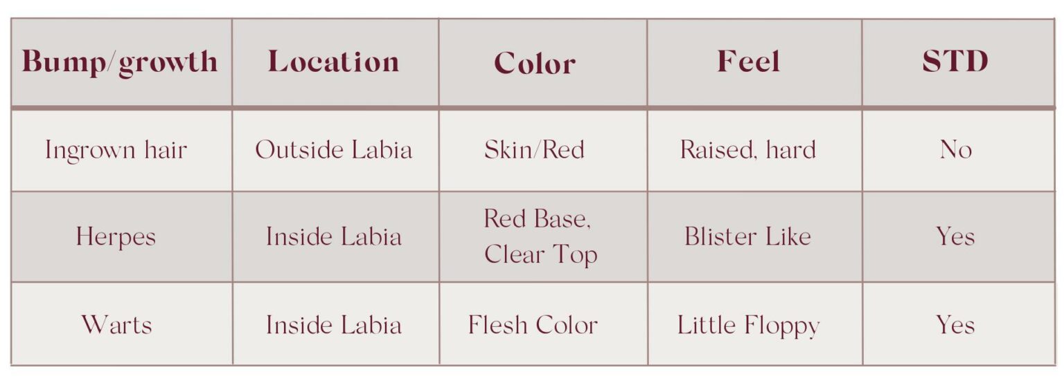 Questions About the Female Anatomy That You Feel Shy to Ask About – RED ...