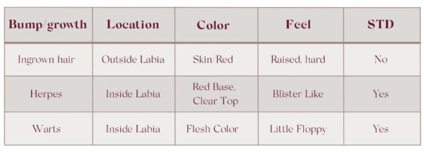 Questions About the Female Anatomy That You Feel Shy to Ask About – RED ...