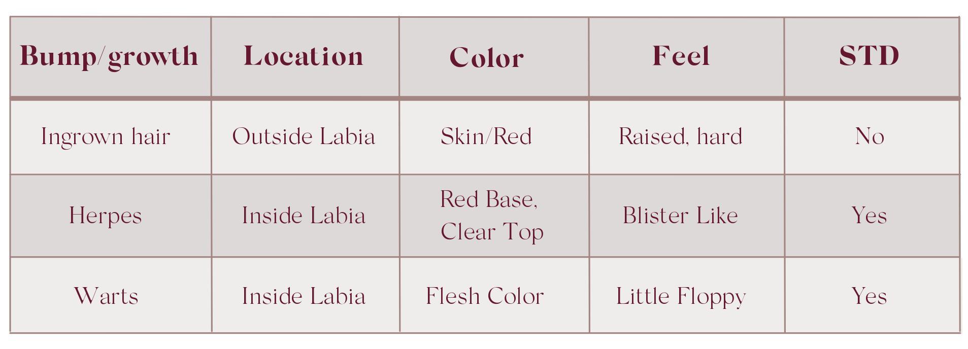 Questions About the Female Anatomy That You Feel Shy to Ask About – RED ...